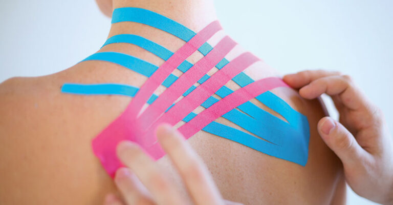 Il Kinesio taping estetico: togliere le rughe con il nastro colorato - CSTM
